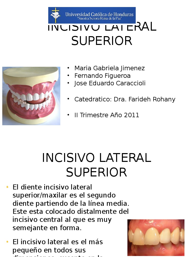 Incisivo Superior Lateral | Anatomia dental | Boca
