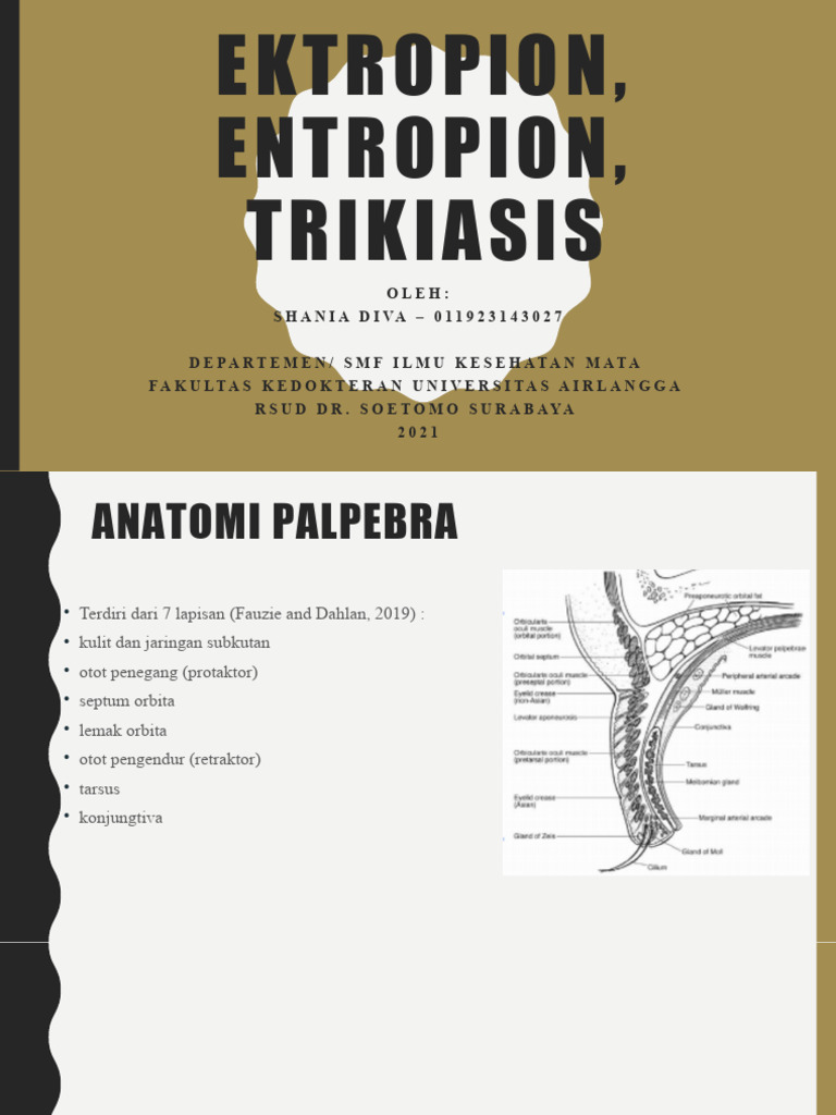 4 PPT Ektropion, Entropion, Trikiasis Shania Diva 011923143027 | PDF ...