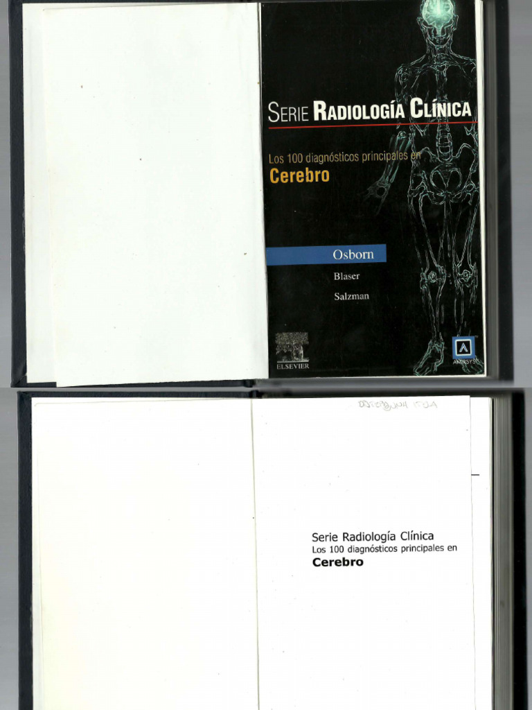Serie Radiologica en El Cerebro by Osborn | PDF