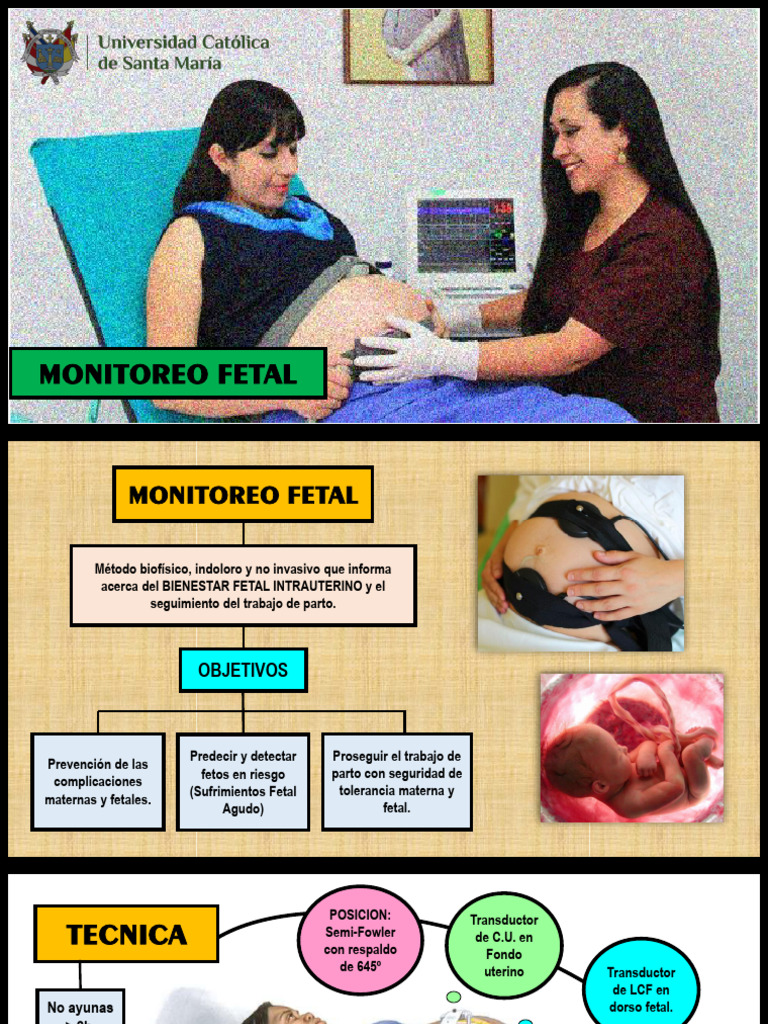 Monitoreo Fetal y Pruebas de Bienestar | PDF | Feto | Parto