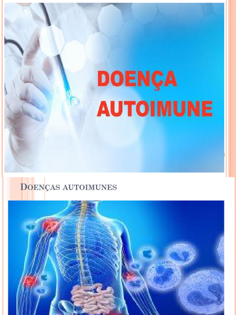 Denças Auto Imune | PDF | Doença autoimune | Imunologia