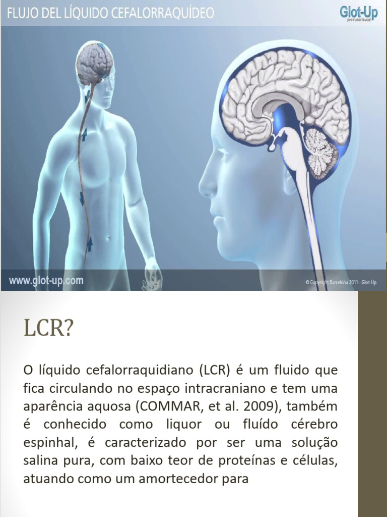 LIQUOR | PDF | Líquido cefalorraquidiano | Anatomia