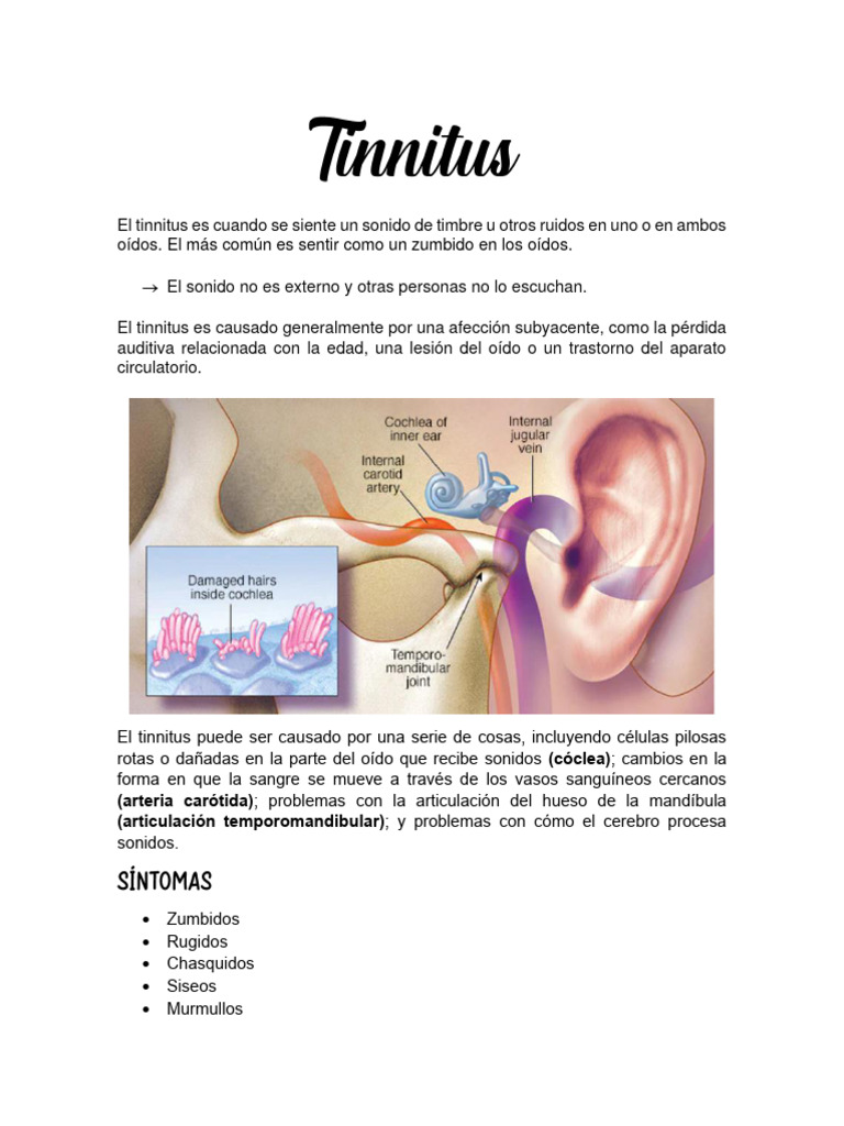 Otorrino Resumen Tinnitus | PDF | Tinnitus | Oído