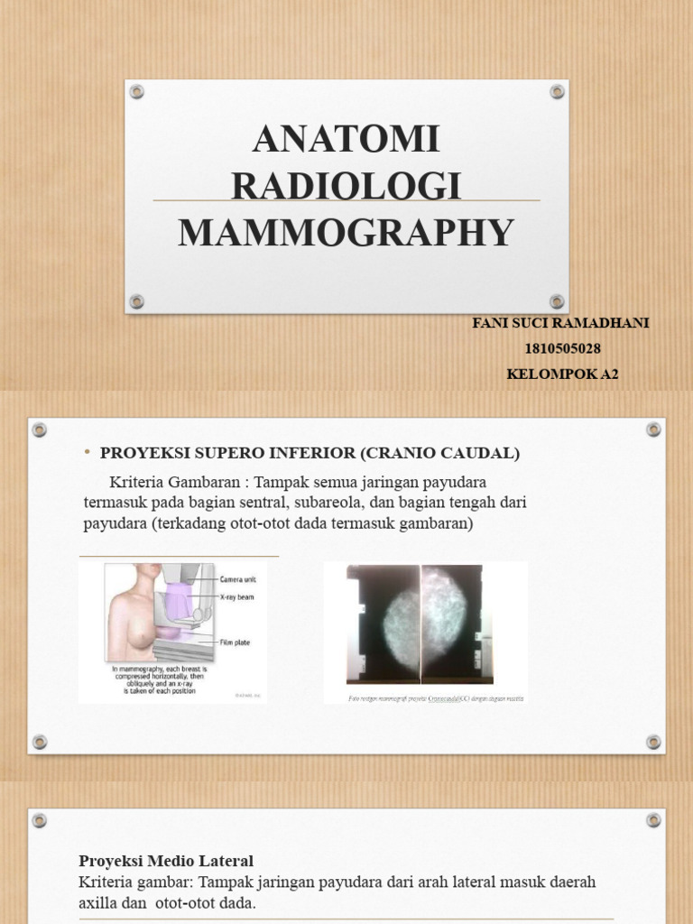 ANATOMI RADIOLOGI MAMMOGRAPHY (1) | PDF