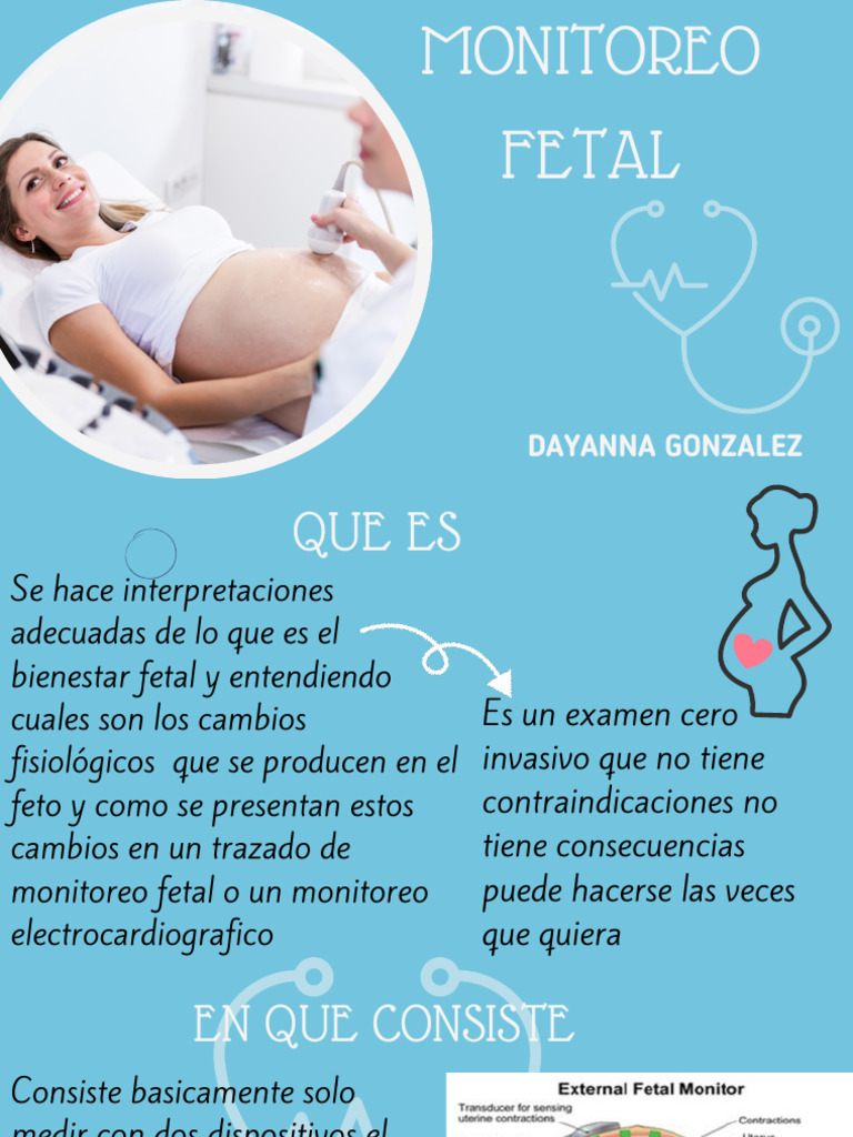 Monitoreo Fetal | PDF