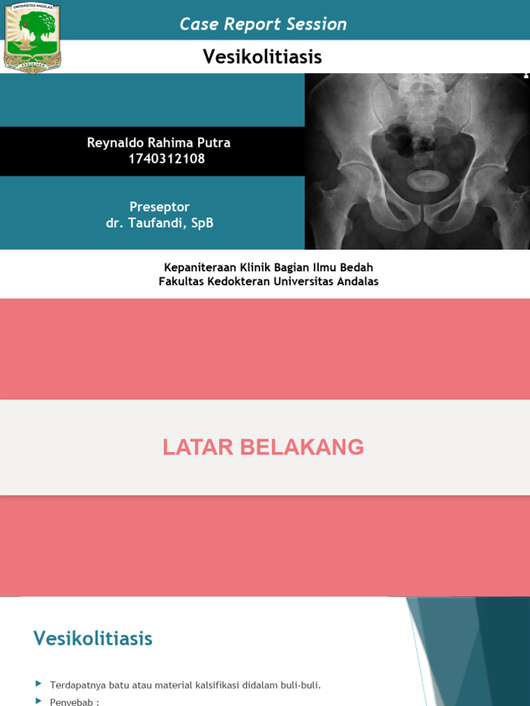 CRS Vesikolitiasis | PDF