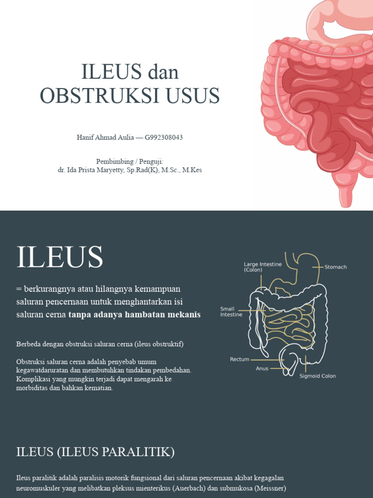 Ileus Dan Obstruksi Usus | PDF