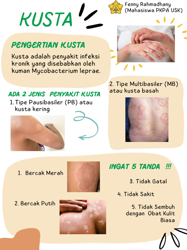 Poster Kusta | PDF | Kesehatan Holistik