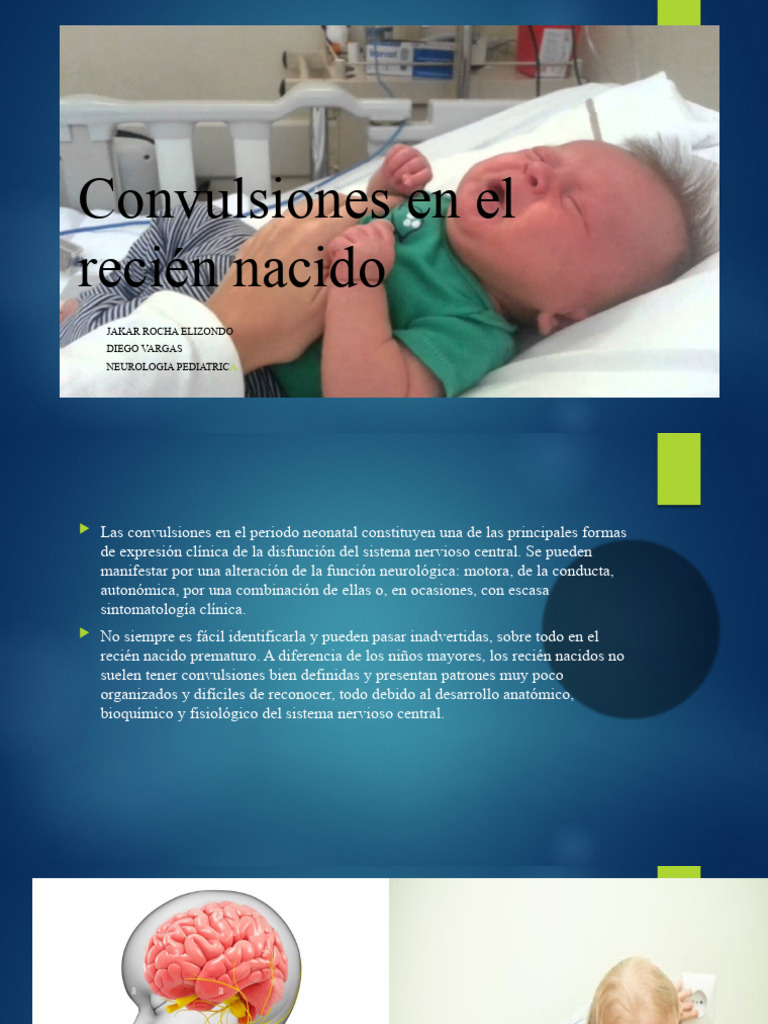 Convulsiones en El Recién Nacido | PDF | Epilepsia | Sistema nervioso