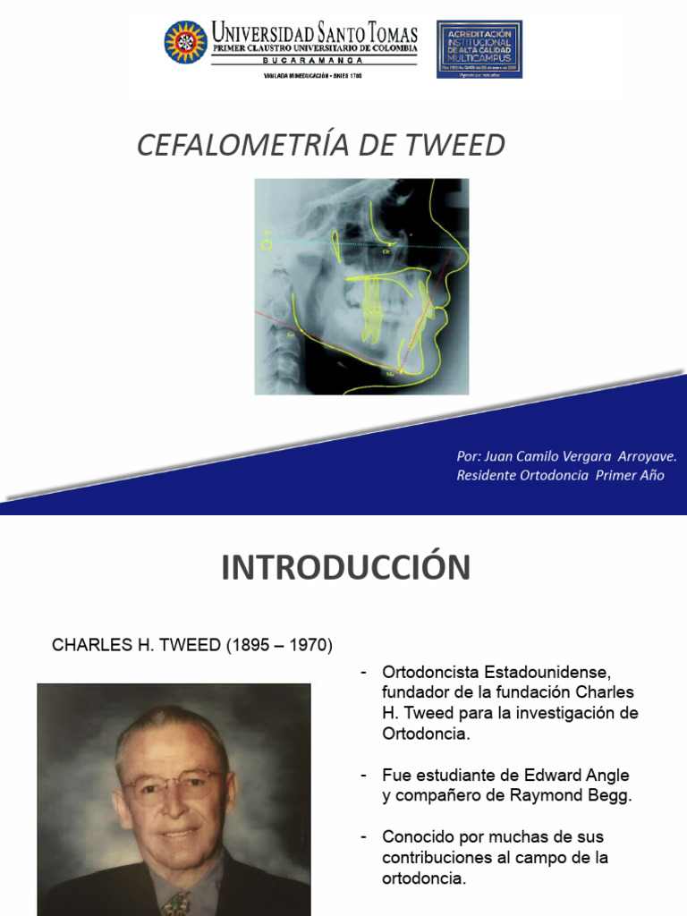 Análisis Cefalométrico de Tweed | PDF | Ramas de Odontología