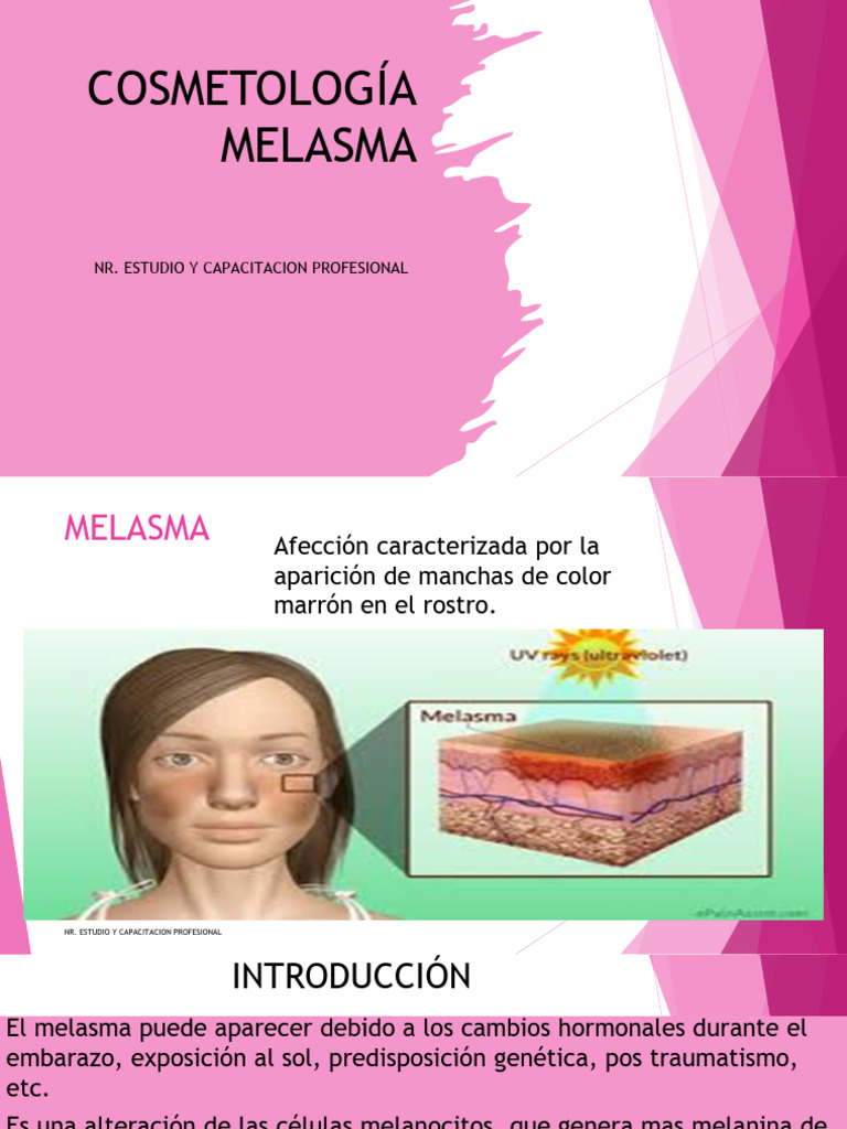 Melasma Cosmetologia | PDF | Protector solar | Ultravioleta