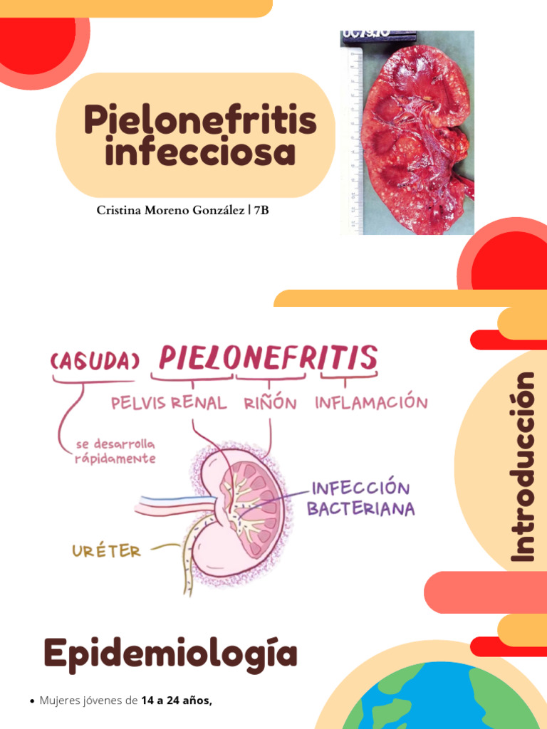 Pielonefritis Corregida | PDF | Infección del tracto urinario | Inmunología