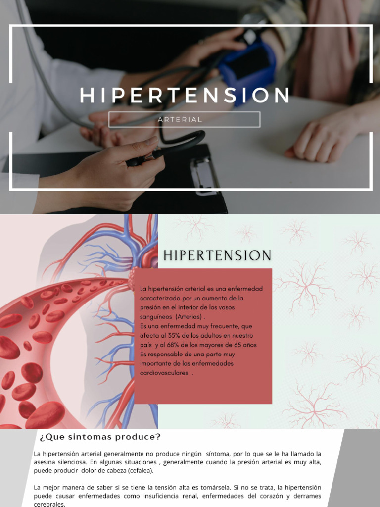 Hipertension | PDF