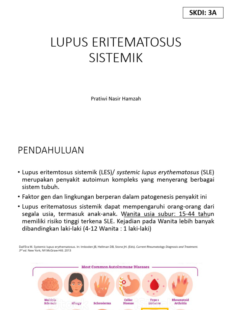 Lupus Eritematosus Sistemik | PDF