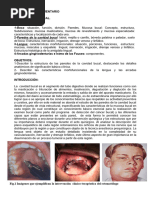 Región Labial de La Cara. | PDF | Labio | Anatomía humana