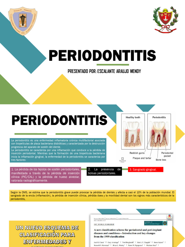Periodontitis | PDF