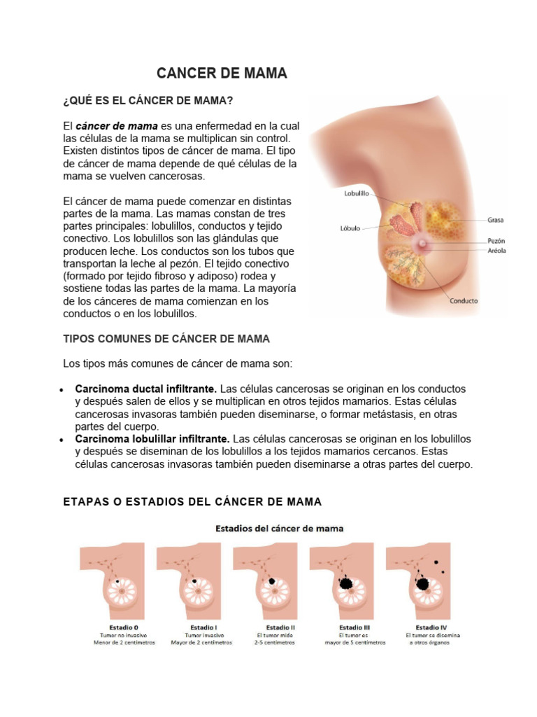 Signos y etapas del cáncer de mama | PDF | Cáncer de mama | Pecho