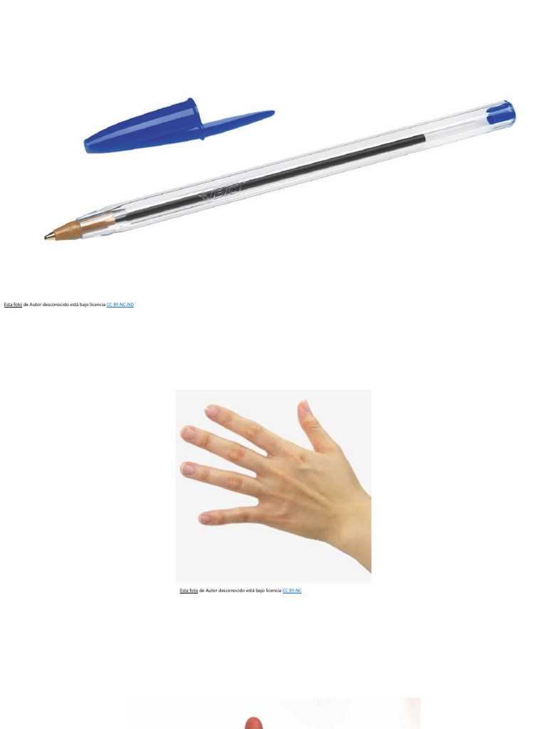 Mississippi Aphasia Screening Test | PDF