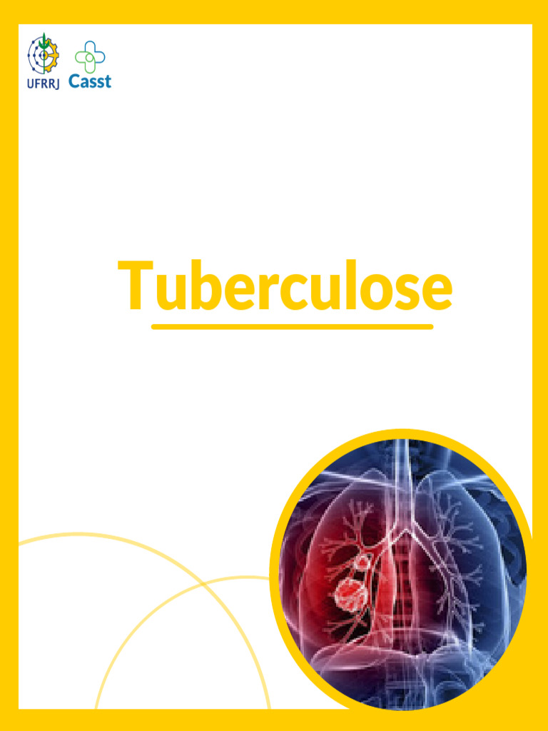 Tuberculose | PDF | Tuberculose | Mycobacterium tuberculosis