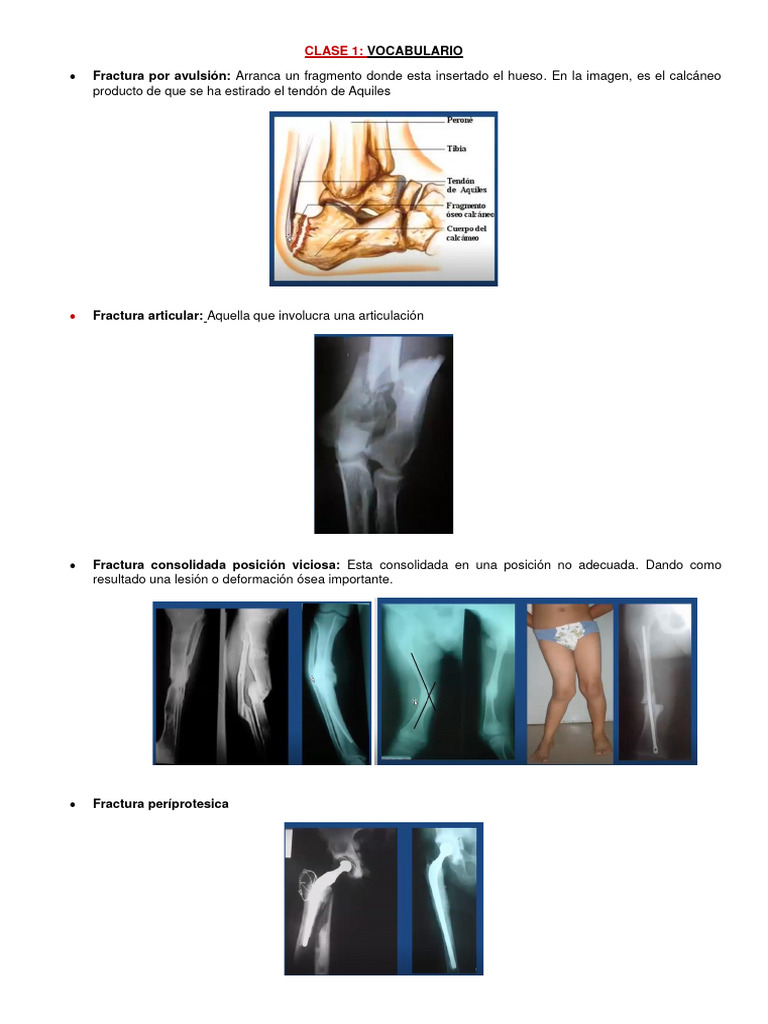 Clases de Traumato 1parcial | PDF | Rodilla | Lesión