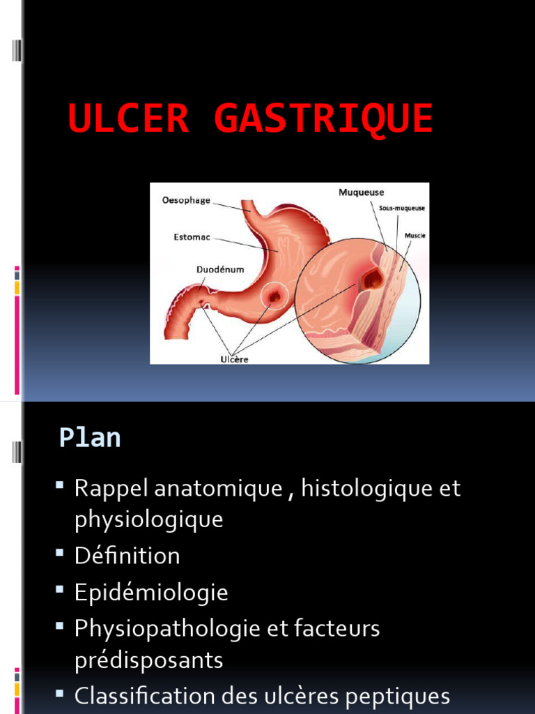 Ulcer Gastrique - Cher | PDF | Estomac | Appareil digestif