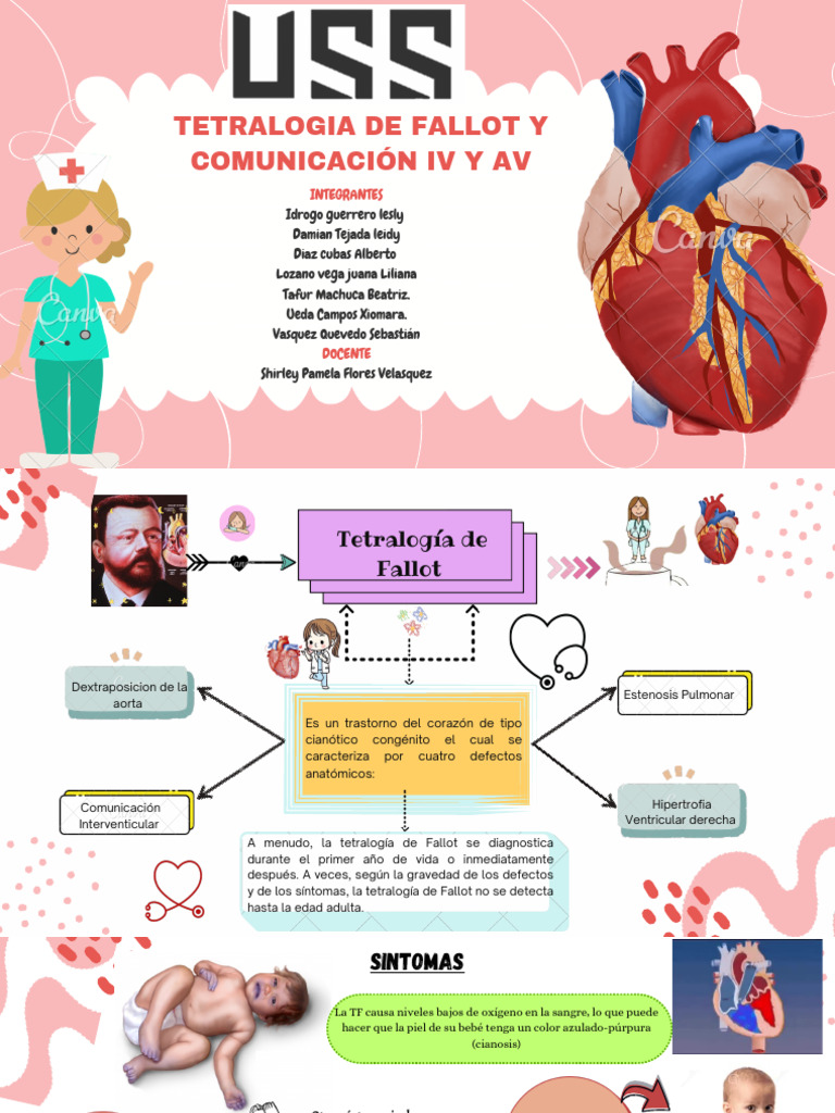 Tetralogia de Fallot Y Comunicación Iv Y Av | PDF | Corazón ...