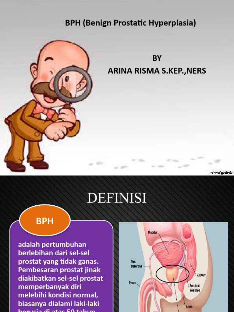 BPH (Benign Prostatic Hyperplasia) | PDF | Pengembangan Diri | Kesehatan Holistik