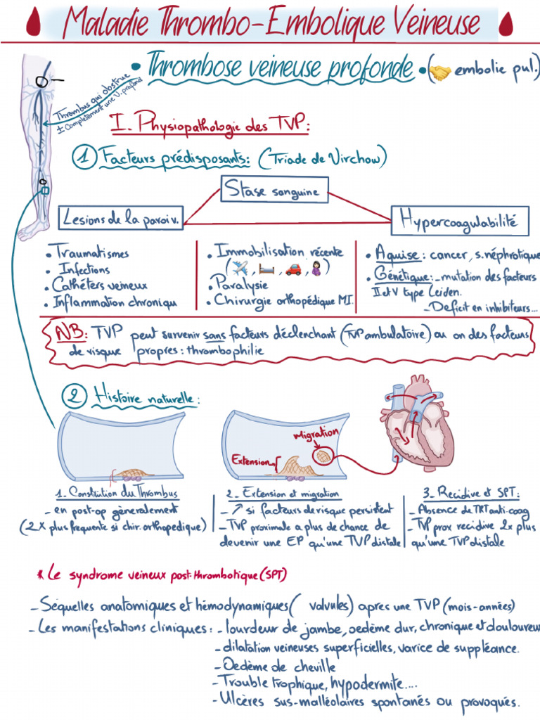 4 - Maladies Veineuses Thromboemboliques (Résumé) | PDF