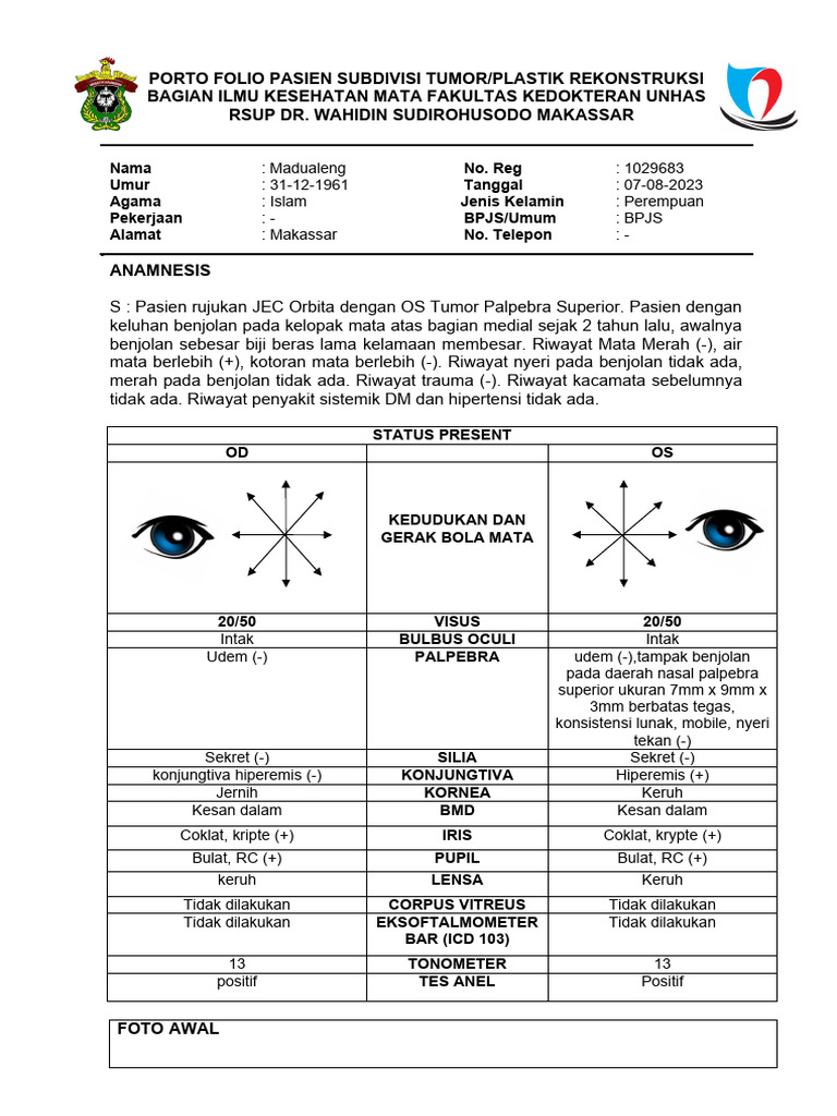 TW03 - Madualeng - OS Tumor Palpebra Superior Susp Kista | PDF