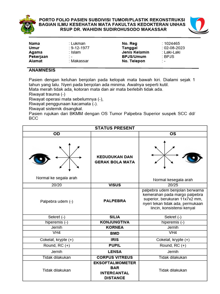 TW01 - Lukman - Oculus Sinistra Post Wide Eksisi + Frozen Section ...