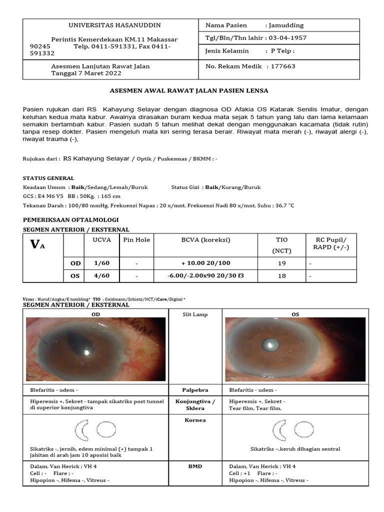 K122-AB-OD Afakia OS Katarak Senil Matur (NO3NC3) | PDF