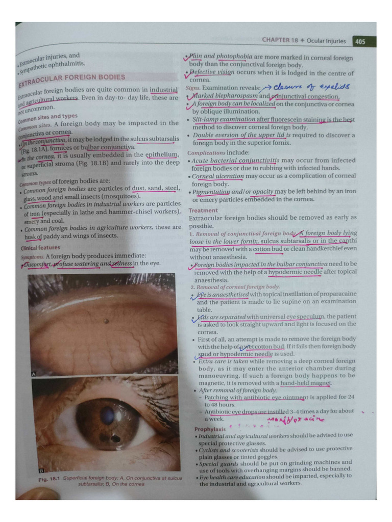 Short Case Eye | PDF