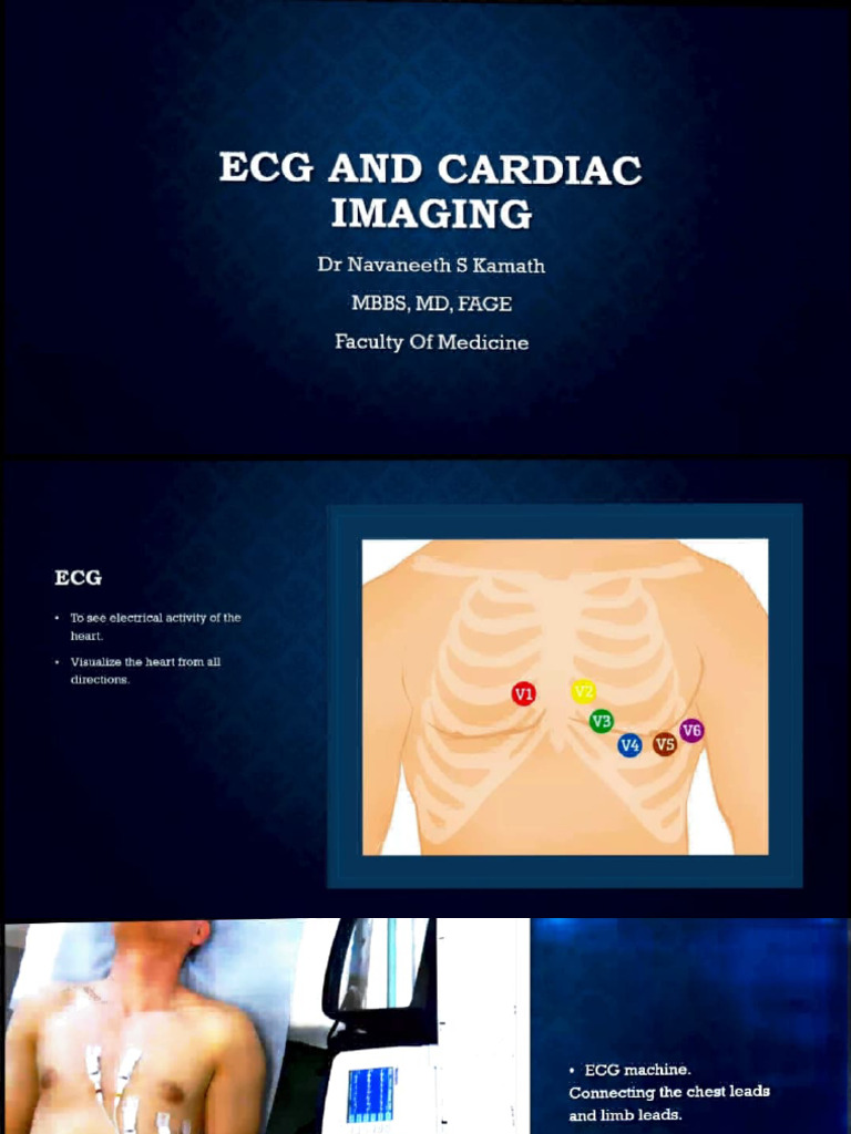 ECG and Cardiac Imaging Overview | PDF | Heart | Coronary Circulation