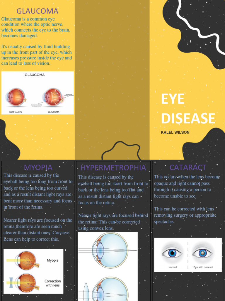 Eye Diseases Overview | PDF | Wellness