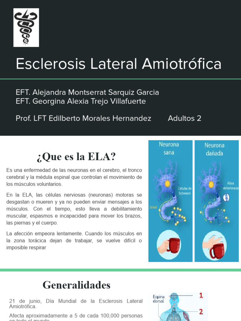 Esclerosis Lateral Amiotrófica | PDF | Terapia física | Biopsia