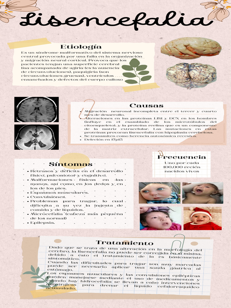Lisencefalia | PDF | Enfermedades y trastornos humanos | Epidemiología
