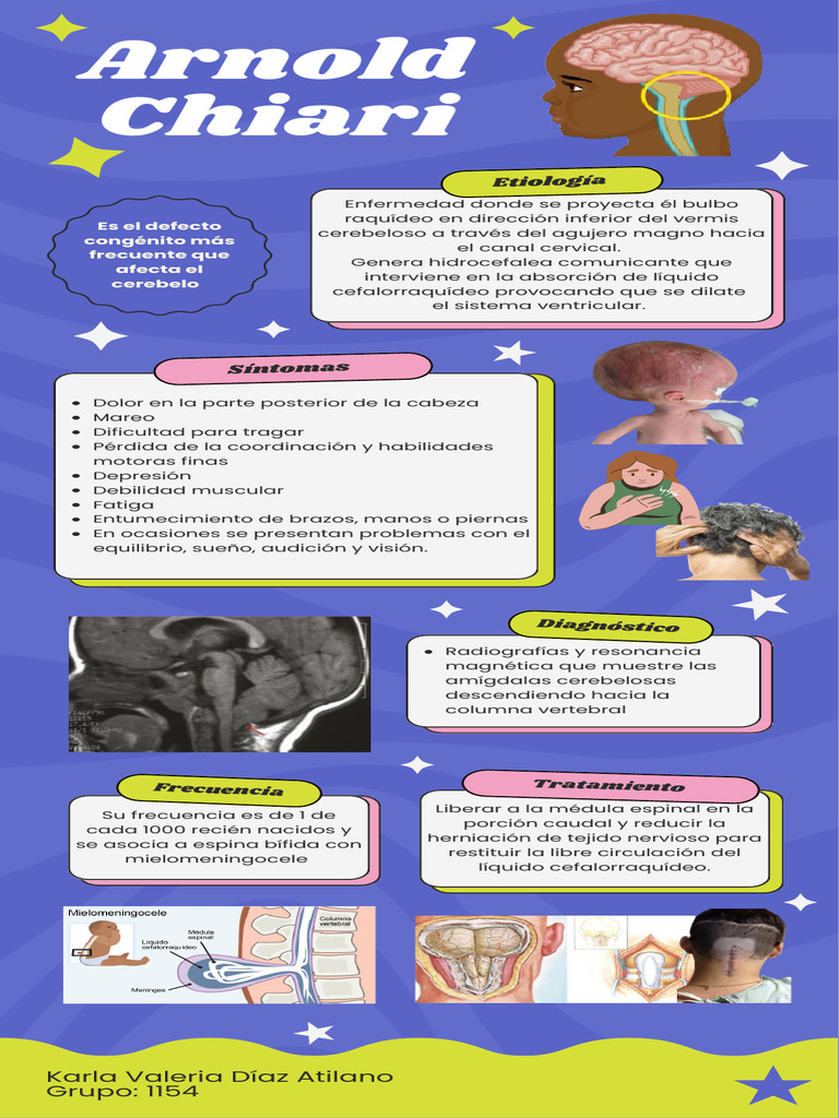 Arnold Chiari | PDF | Enfermedades y trastornos humanos | Medicina CLINICA