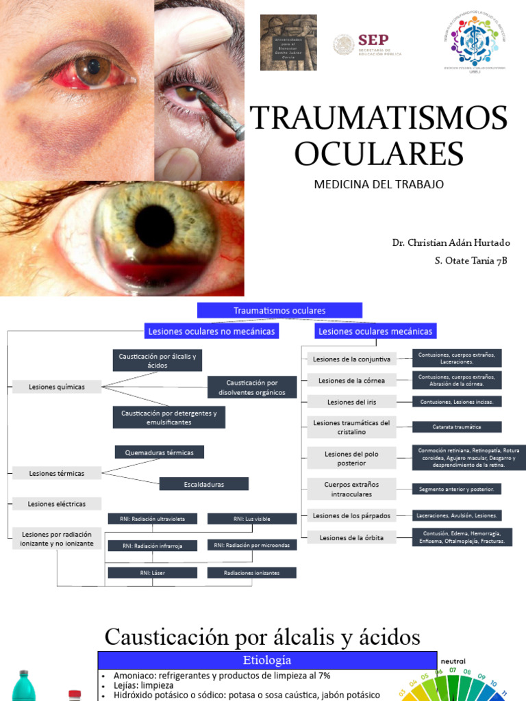 Traumatismos Oculares | PDF | Quemar | Lesión
