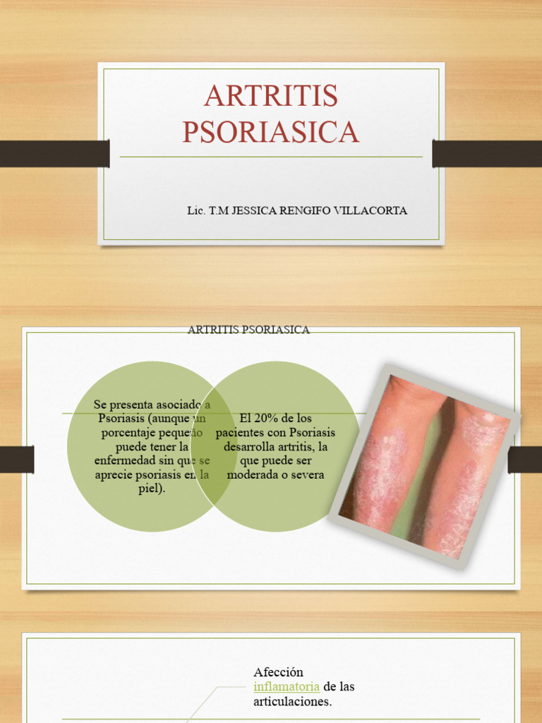 ARTRITIS PSORIASICA Lic. Jessica Rengifo | PDF