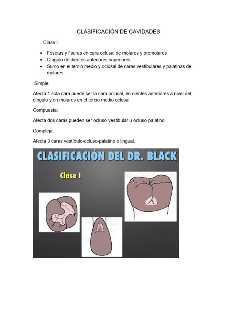 Clasificación de Cavidades según Black | PDF | Ciencia y matemáticas