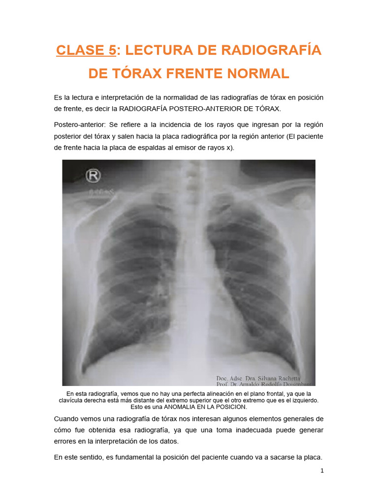Lectura de Radiografía de Tórax Frente Normal | Descargar gratis PDF ...