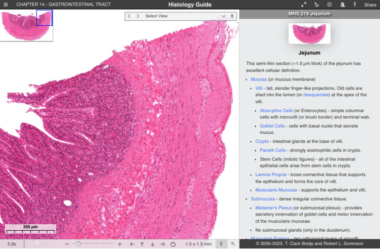 Jejunum Histology Overview | PDF | Epithelium | Gastrointestinal Tract
