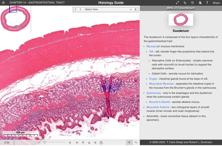 Duodenum (Small Intestine) Gastrointestinal Tract | Download Free PDF ...