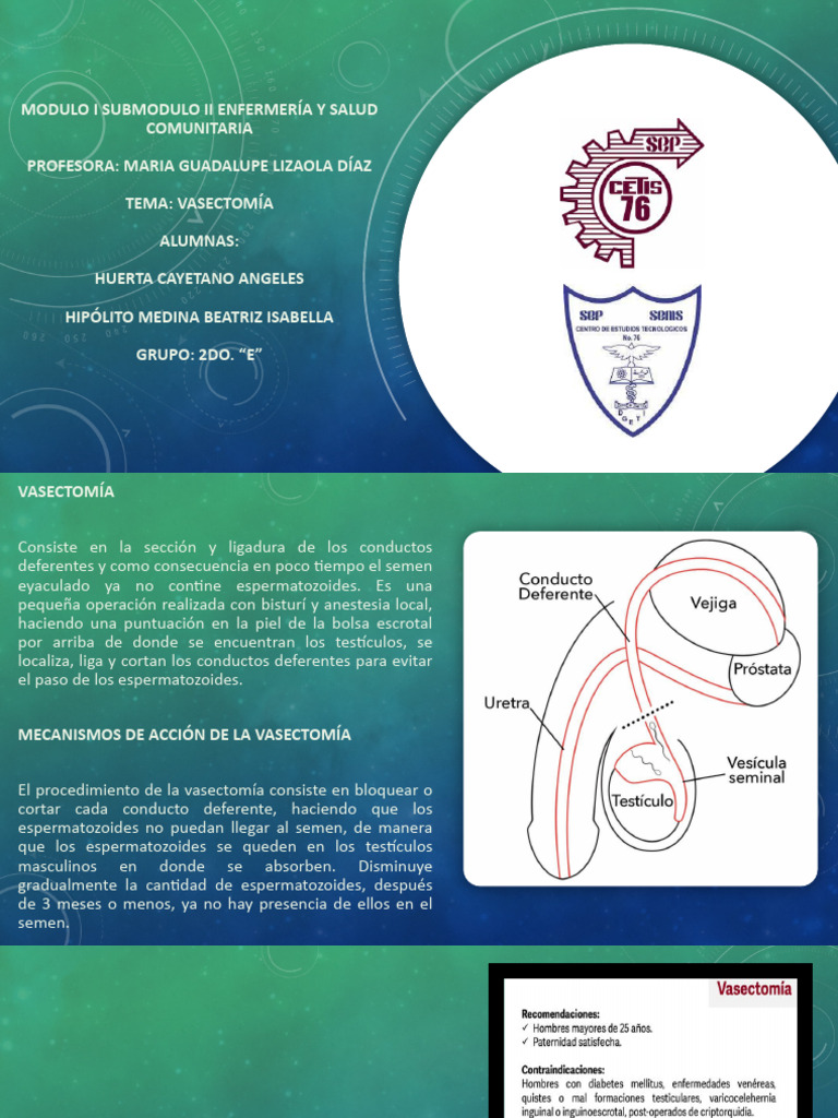 Vasectomía: Indicaciones y Contraindicaciones | PDF