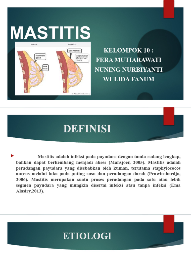 MASTITIS | PDF