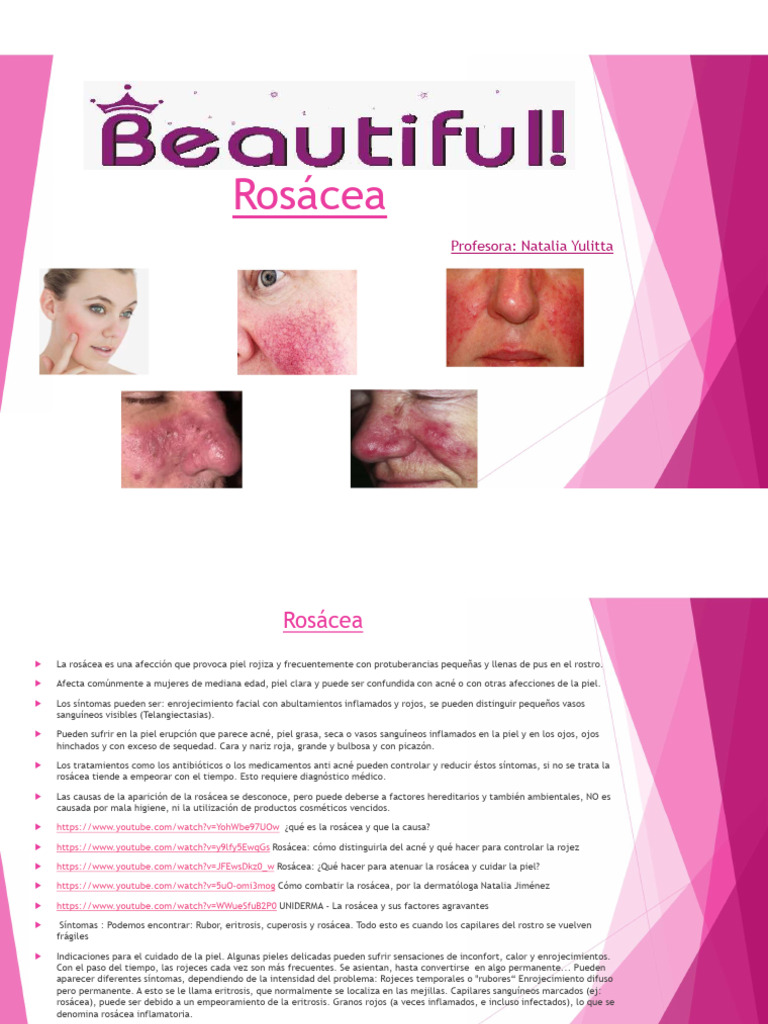 13 Patologías de La Piel Rosácea Clase 13 | PDF | Medicina CLINICA ...