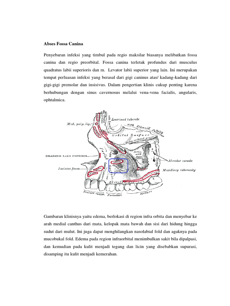 Abses Fossa Canina | PDF | Kajian Bahasa Asing
