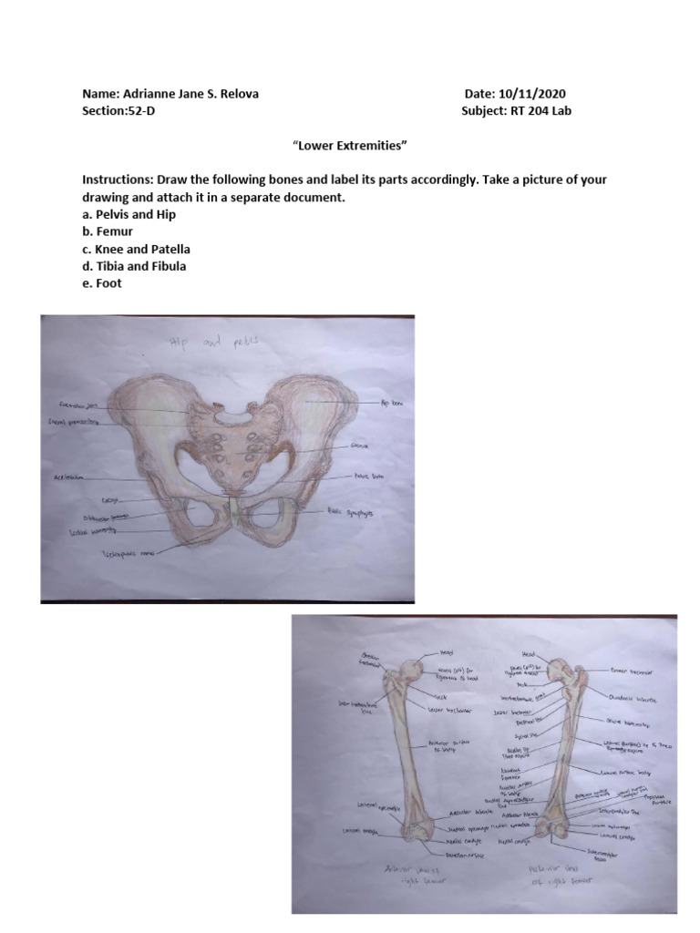 Lower Extermity Relova | PDF
