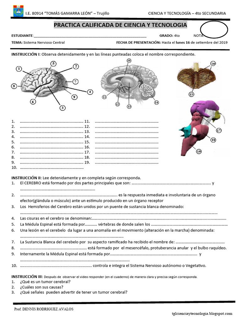 PRACTICA 4to SIST NERVIOSO CENTRAL TGL 2023 | PDF