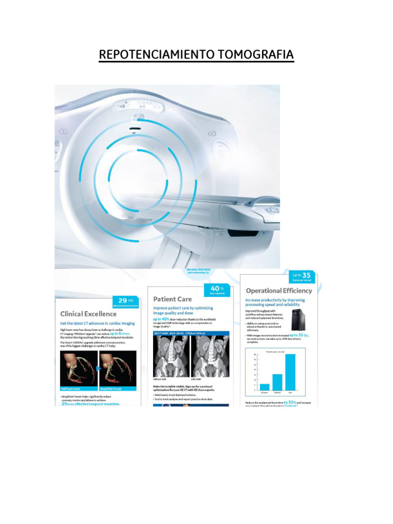 Avances en Tomografía LightSpeed VCT | PDF | Ct Scan | Imagenes medicas